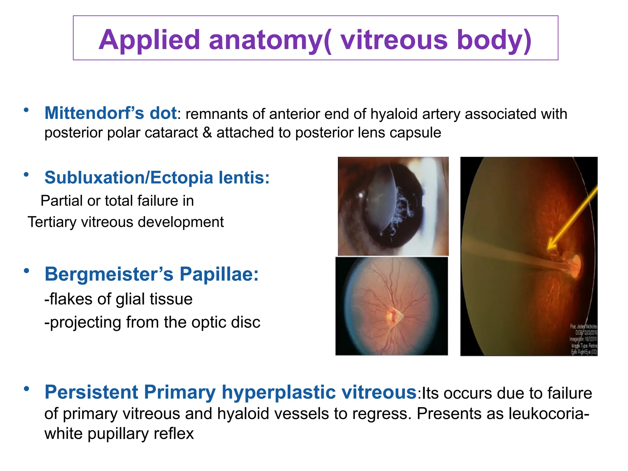 Anatomy and physiology Vitreous ppt final.pptx