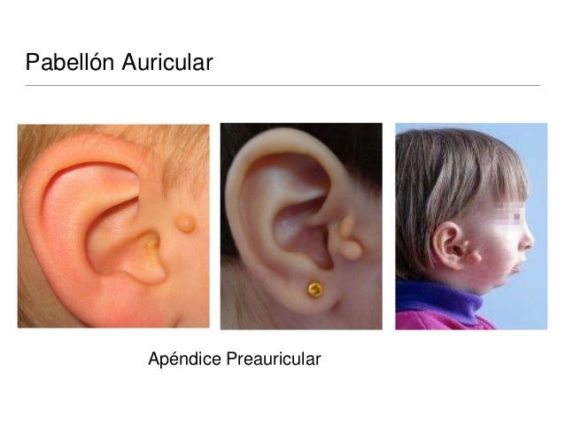 UVM Clinica Medica Integral Sesion 12 Audicion