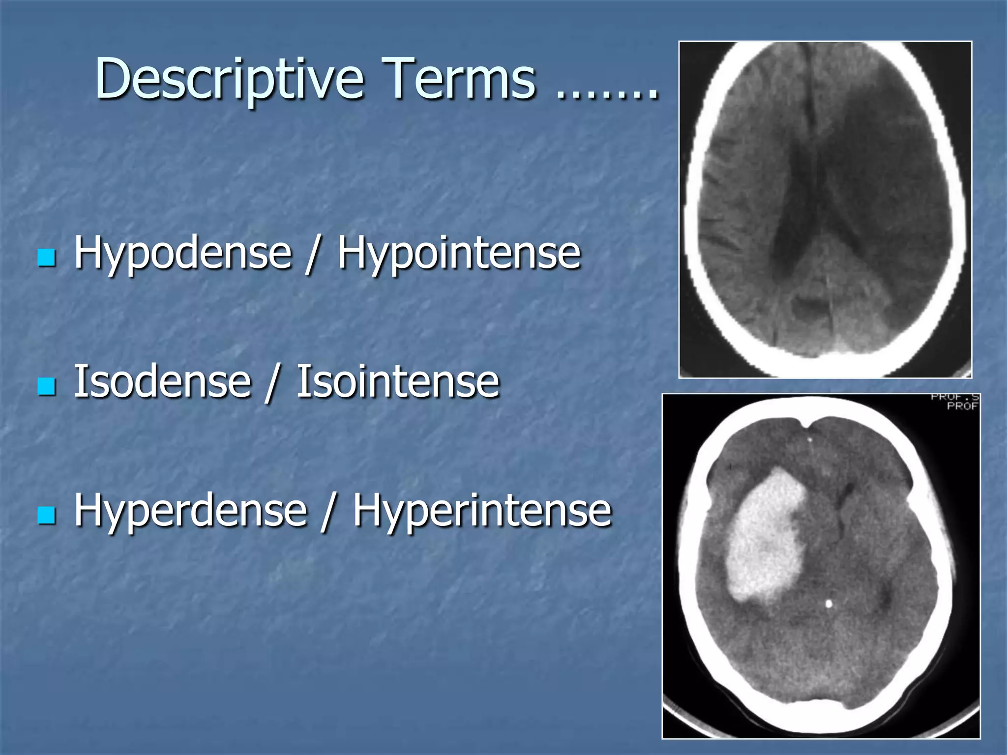 12 b. ct brain | PPT