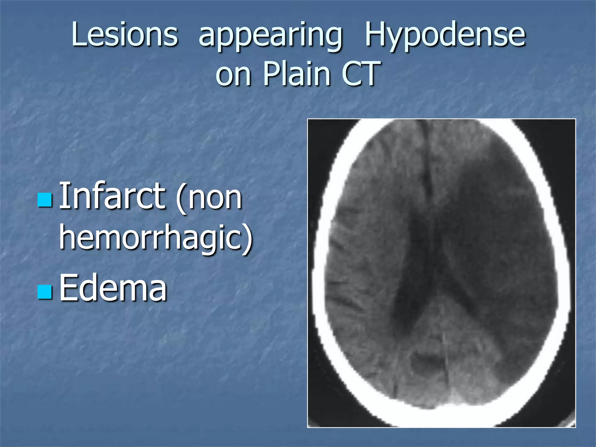 12 b. ct brain | PPT
