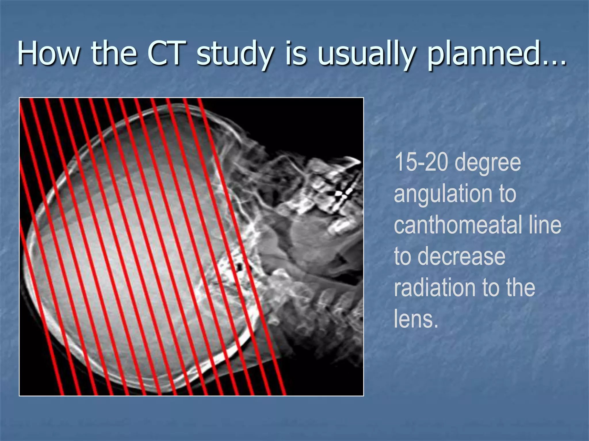 12 b. ct brain | PPT | Death, Injury, or Military Conflict | Sensitive Topics