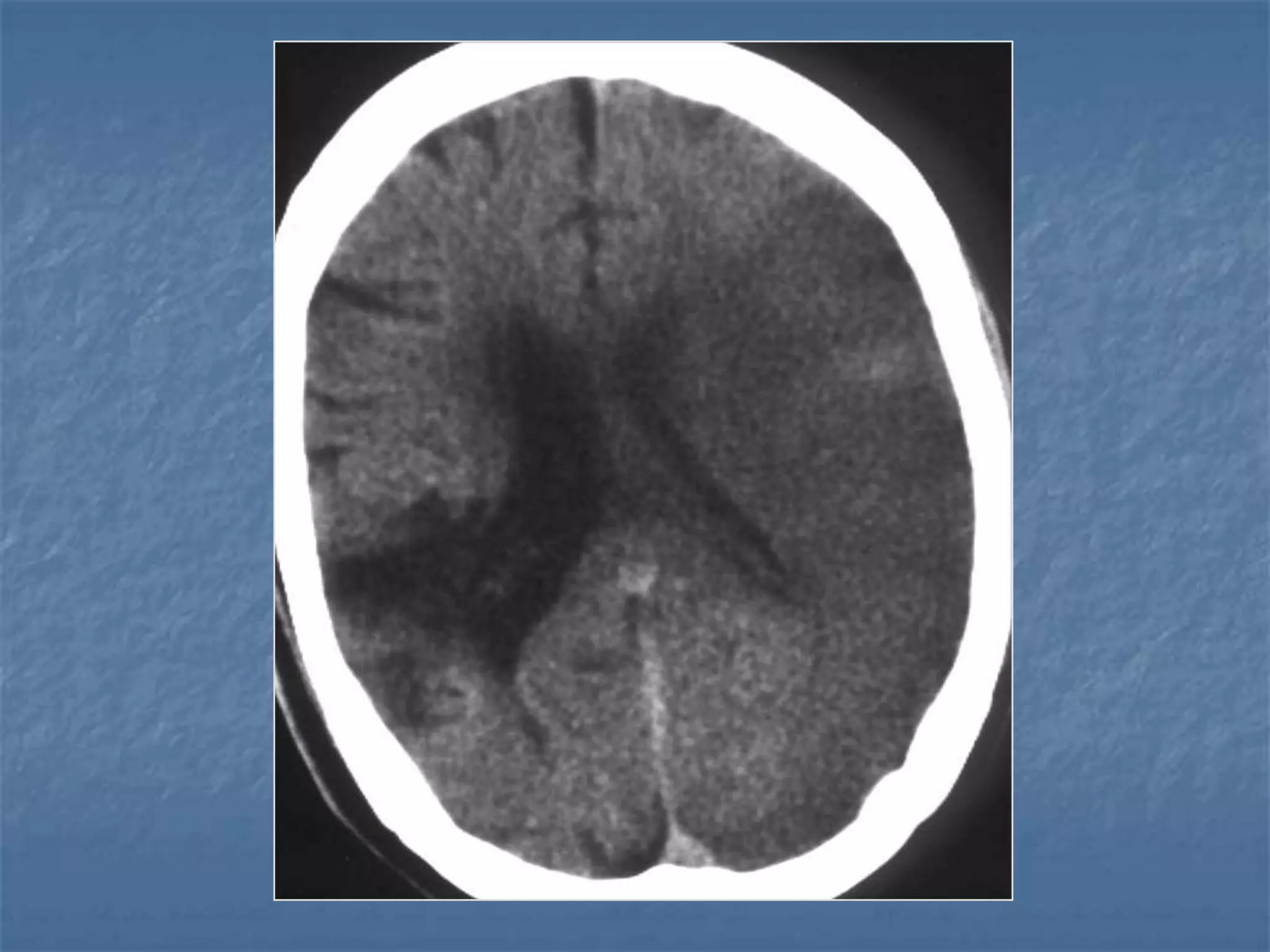 12 b. ct brain | PPT | Death, Injury, or Military Conflict | Sensitive Topics