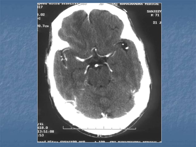 12 b. ct brain | PPT