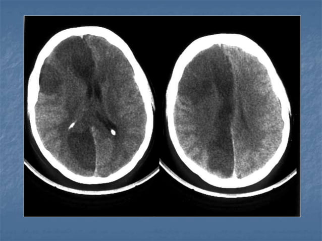 12 b. ct brain | PPT | Death, Injury, or Military Conflict | Sensitive Topics
