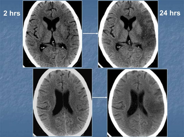 12 b. ct brain | PPT
