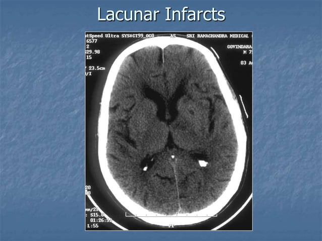 12 b. ct brain | PPT | Death, Injury, or Military Conflict | Sensitive Topics