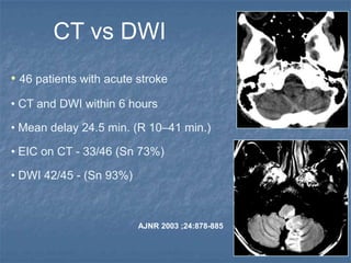 12 b. ct brain | PPT