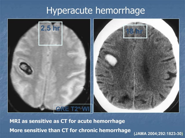 12 b. ct brain | PPT | Death, Injury, or Military Conflict | Sensitive Topics