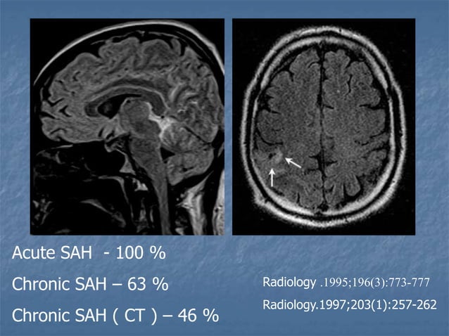 12 b. ct brain | PPT | Death, Injury, or Military Conflict | Sensitive Topics