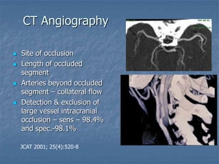 12 b. ct brain | PPT