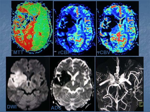 12 b. ct brain | PPT | Death, Injury, or Military Conflict | Sensitive Topics