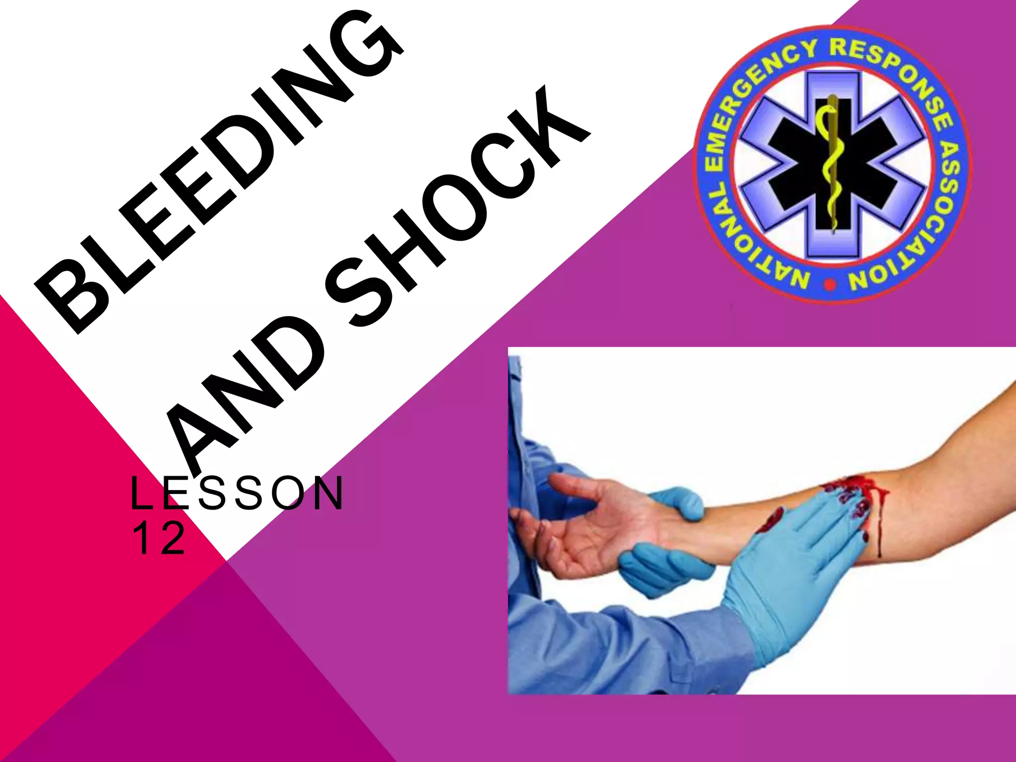 12 bleeding and_shock | PPT