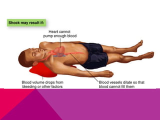 12 bleeding and_shock | PPT
