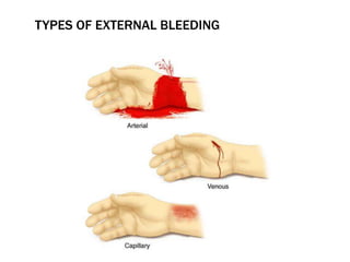 12 bleeding and_shock | PPT