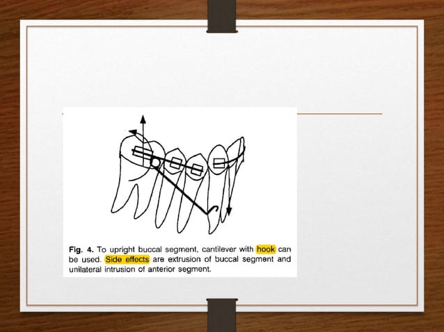 canted occlusal plane | PPTX