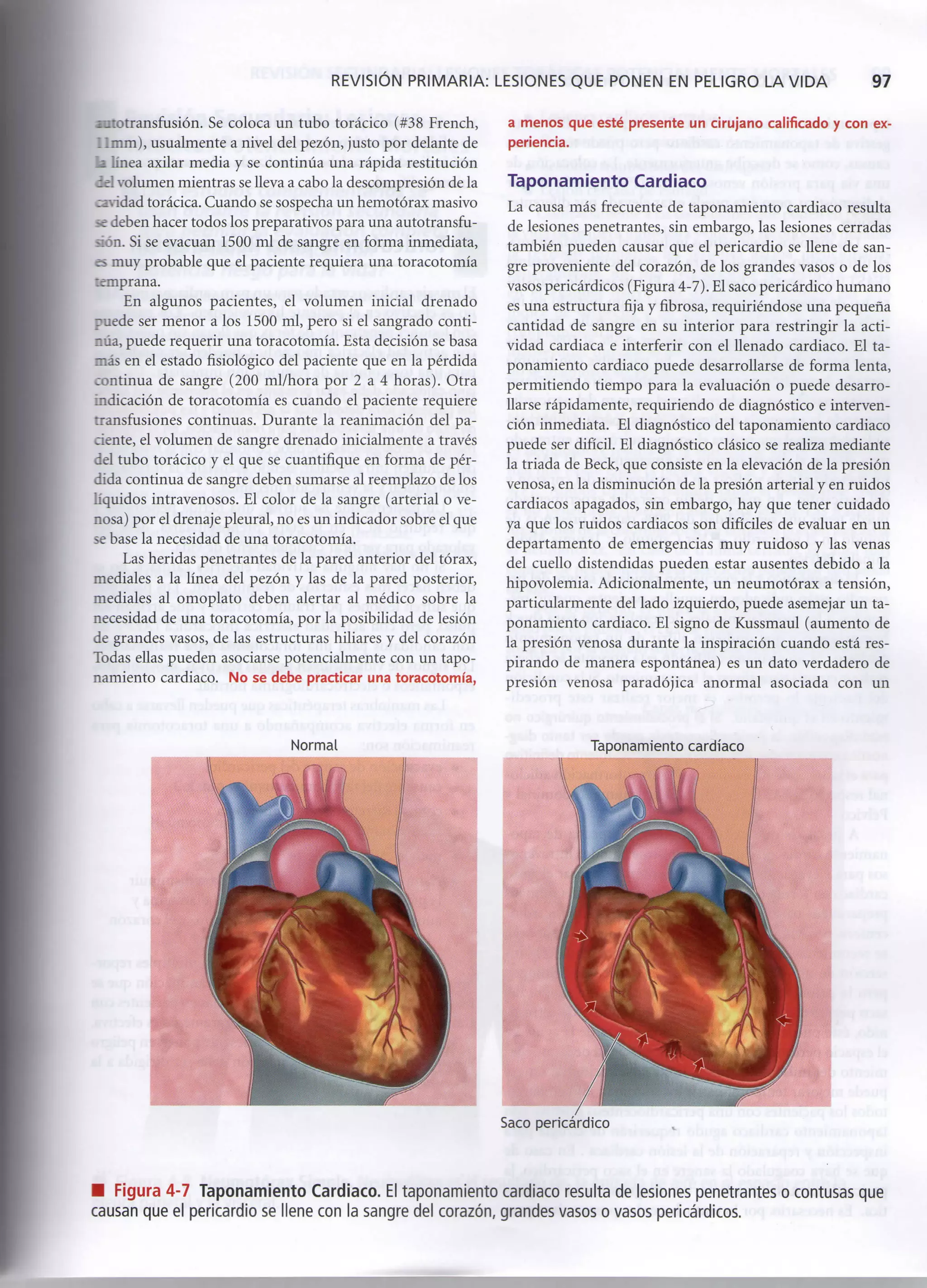 Trauma toracico ATLS. MANEJO INICIAL | PDF