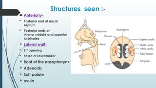 12, CLINICAL EXAMINATION OF NOSE. practical purpose | PPT
