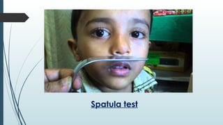 12, CLINICAL EXAMINATION OF NOSE. practical purpose | PPTX