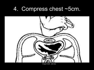 Cardiopulmonary resuscitation | PPTX | First Aid | Injuries
