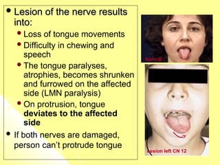 Anatomy 12 pair Cranial Nerves 11 & 12 .pptx