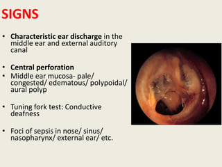 12 csom tubotympanic | PPT