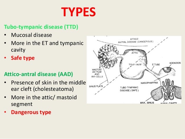 12 csom tubotympanic