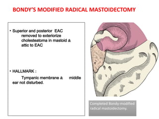 CSOM SURGERIES | PPT