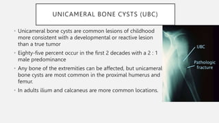 Cystic lesions of bone.pptx