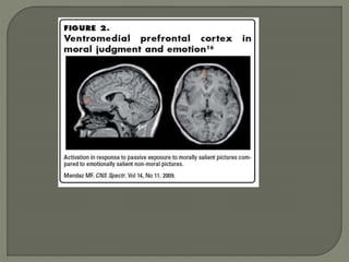 Presentation for Affective Neuroscience on Somatic Marker Hypothesis | PPTX