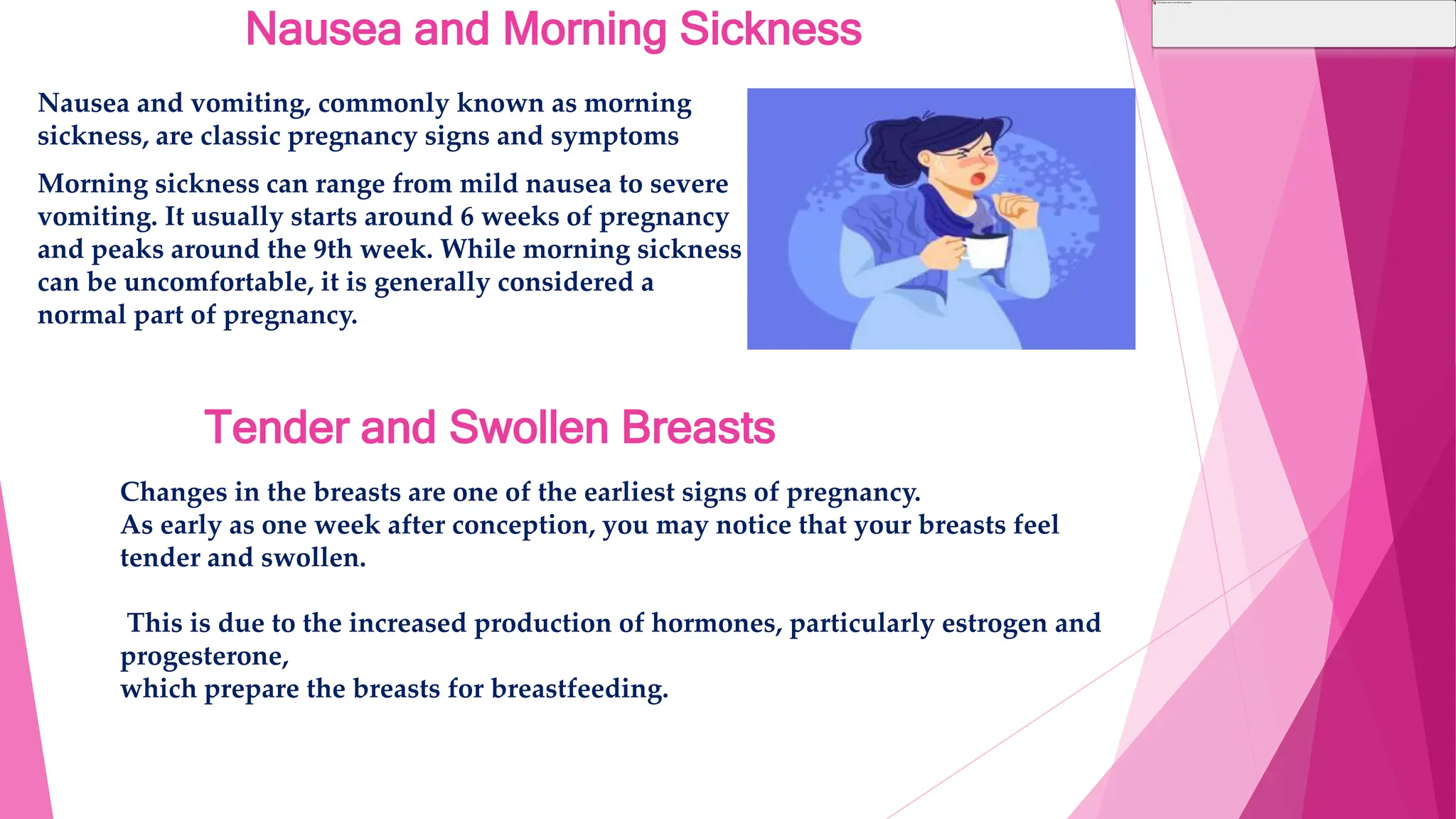 12 Early Signs of Pregnancy Symptoms.pptx