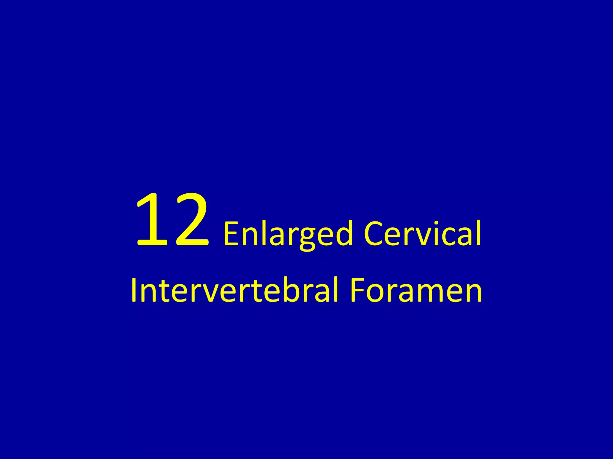 12 enlarged cervical intervertebral foramen | PPT