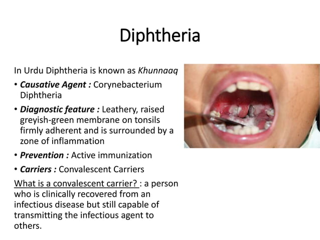 EPI Schedule and diseases.pptx | Ear, Nose and Throat Conditions ...