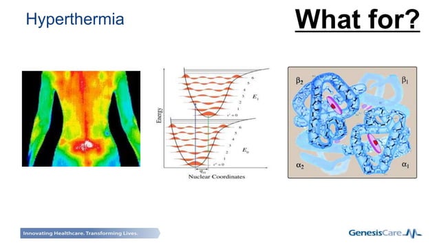 Felix Navarro - Hyperthermia | PPTX | Cancer | Diseases and Conditions