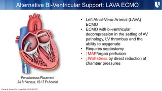 Mechanical Circulatory Support Devices in the Management of Cardiogenic ...