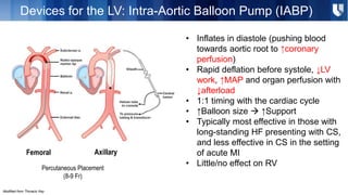 Mechanical Circulatory Support Devices in the Management of Cardiogenic ...
