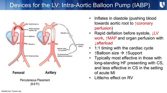 Mechanical Circulatory Support Devices in the Management of Cardiogenic ...