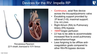 Mechanical Circulatory Support Devices in the Management of Cardiogenic ...