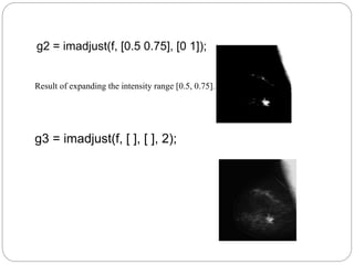 Intensity Transformation and Spatial filtering | PPTX