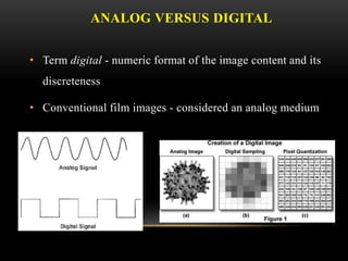 12intraoral digital radiography | PPTX