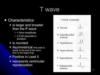 12 Lead Basics | PPT