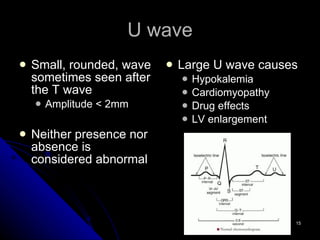 12 Lead Basics | PPT