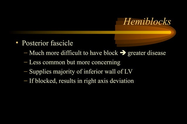 12LeadBlocks.ppt 12 Lead ECGs: Bundle Branch Blocks & Hemiblocks | PPT