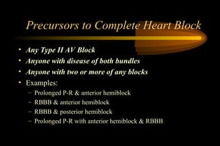 12LeadBlocks.ppt 12 Lead ECGs: Bundle Branch Blocks & Hemiblocks | PPT