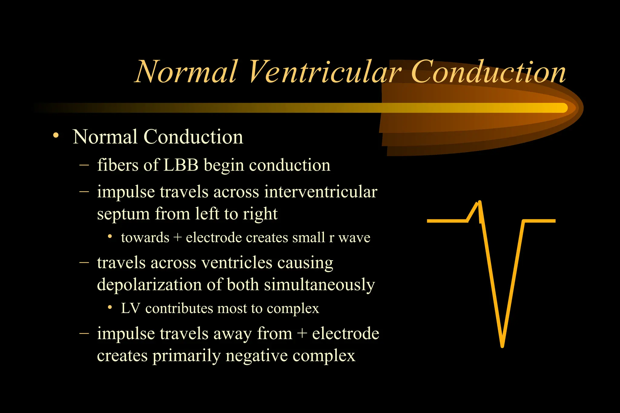 12LeadBlocks.ppt 12 lead bundle branch block | PPT