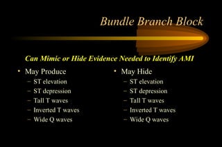 12LeadBlocks.ppt 12 lead bundle branch block | PPT