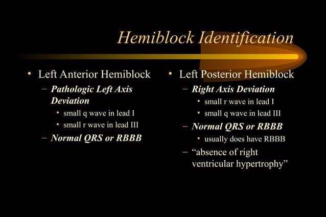 12LeadBlocks.ppt 12 lead bundle branch block | PPT