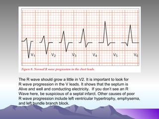 12 lead ecg | PPT