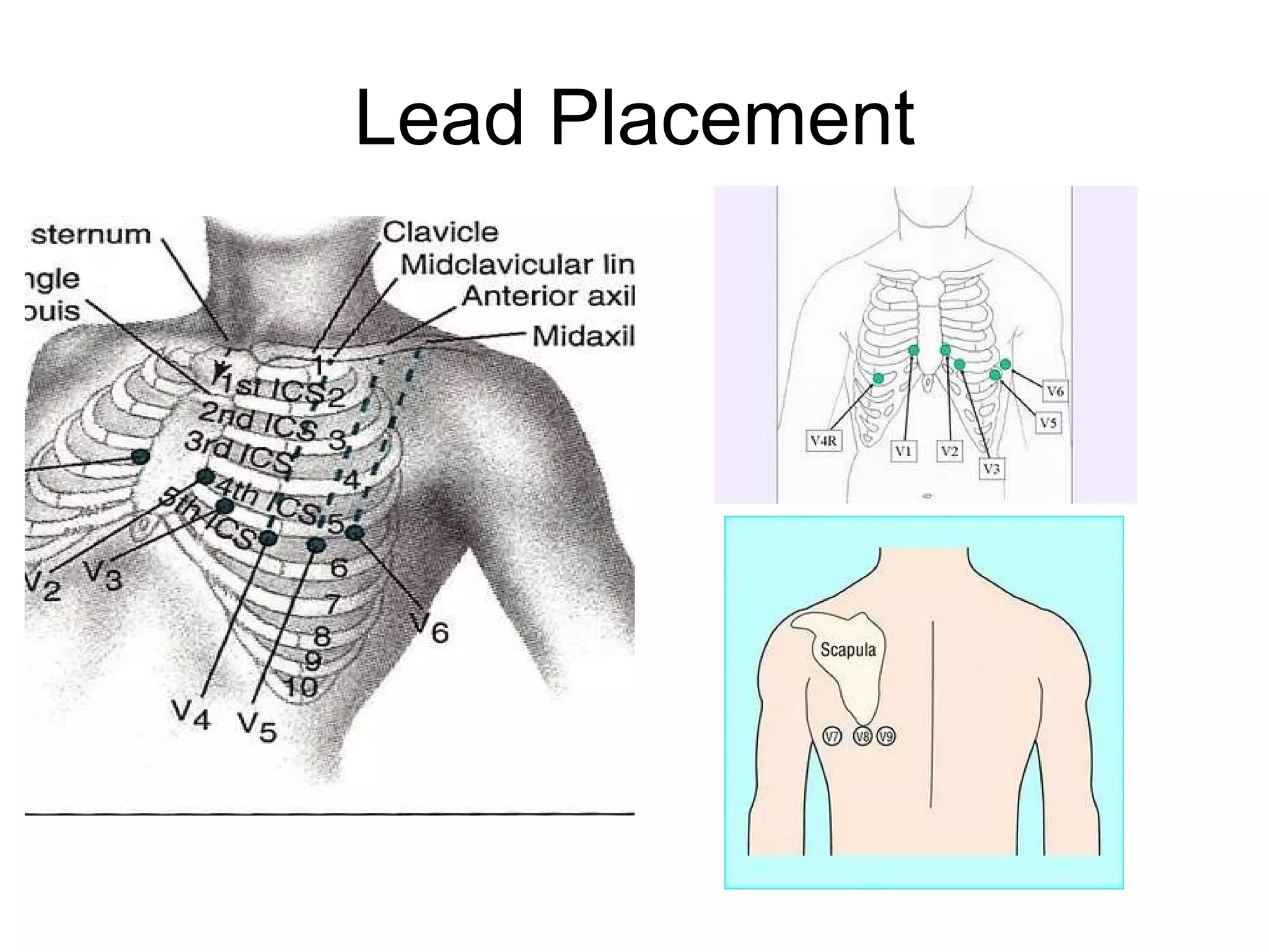 12 lead ecg | PPT