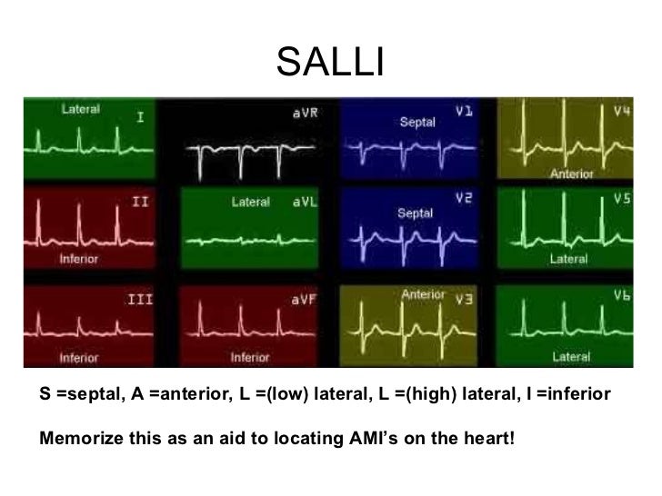 12 lead ecg