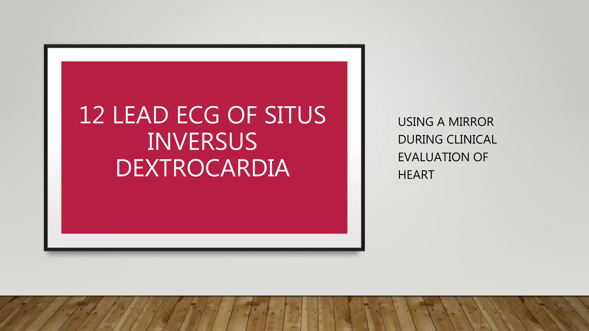 12 lead ecg of situs inversus dextrocardia | PPTX
